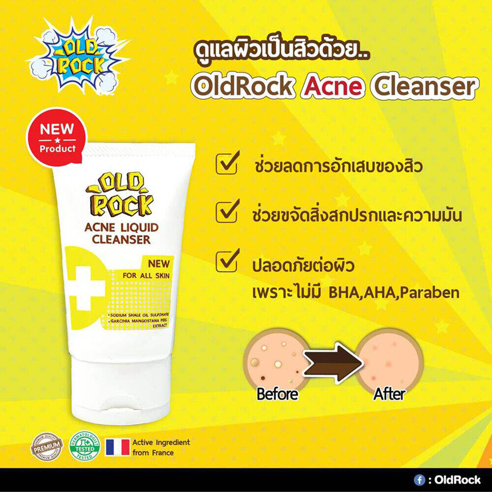 OLD ROCK Acne Liquid Cleanser 30ml ( สินค้าหมดอายุ : 2021.03 )